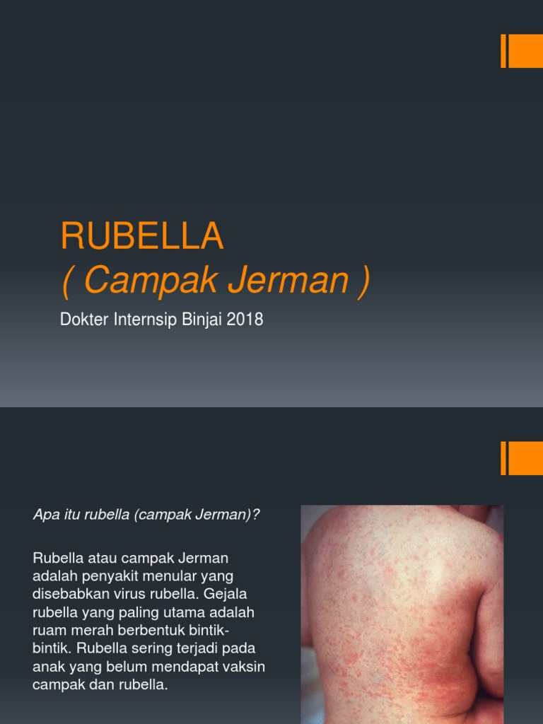 Rubella | PDF