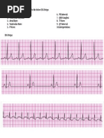EKG Pocket Guide | PDF | Cardiac Electrophysiology | Electrocardiography