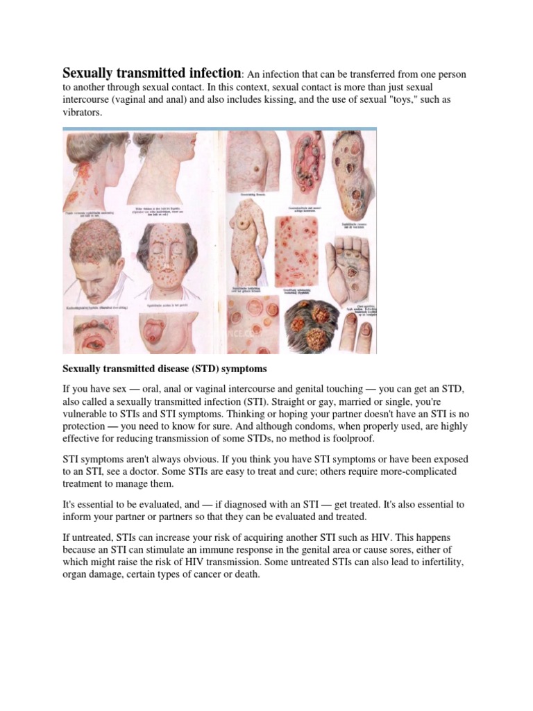 Sexually Transmitted Disease or STI Complete Symtoms | Download Free ...