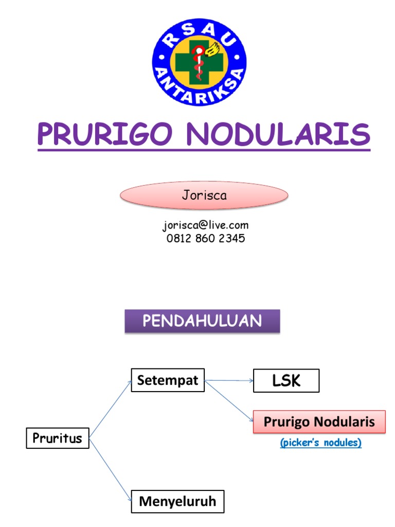 Prurigo Nodularis | PDF