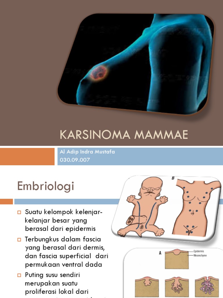 Referat CA Mammae | PDF