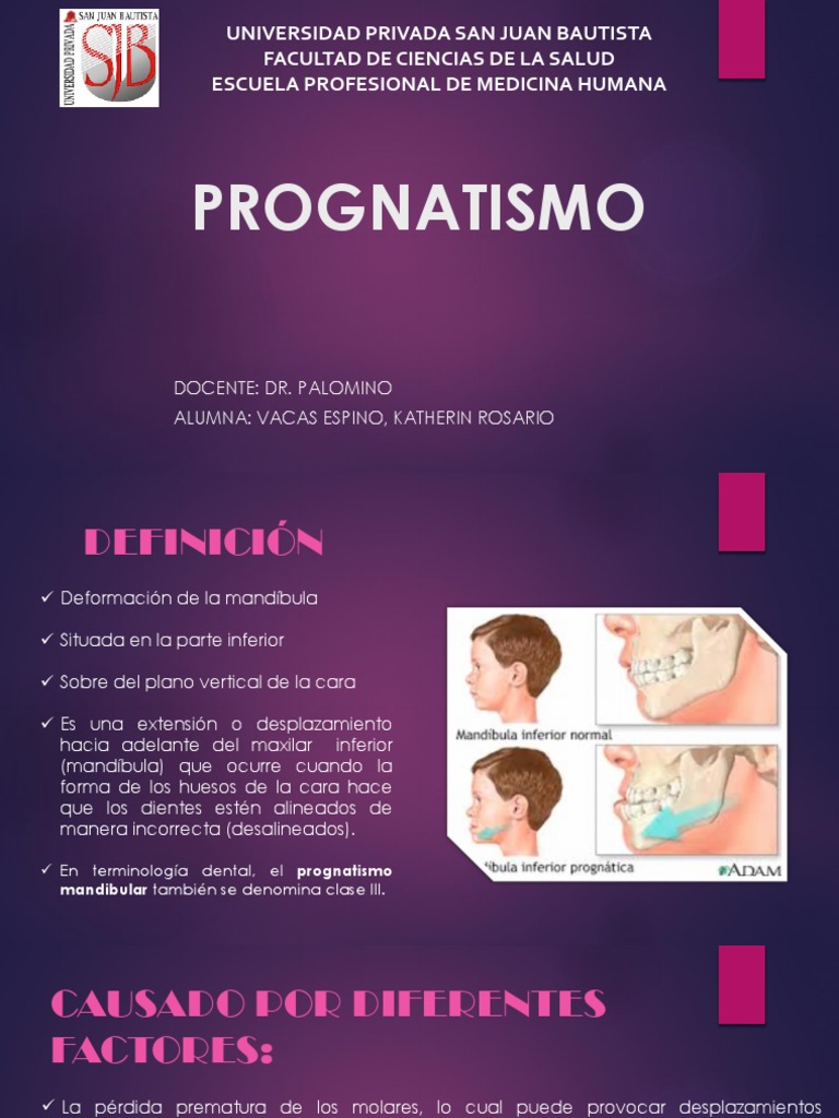 PROGNATISMO | PDF | Boca | Cara