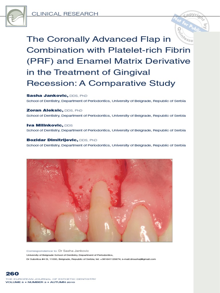 The Coronally Advanced Flap in Combination With Platelet-Rich Fibrin ...