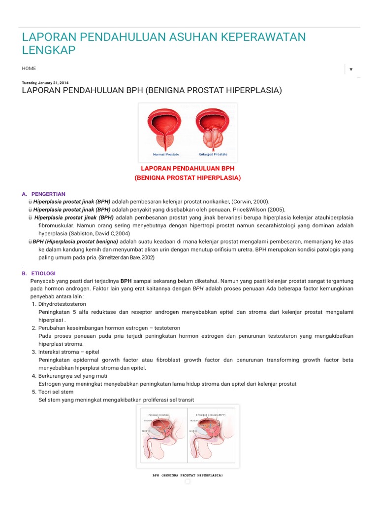 Laporan Pendahuluan Asuhan Keperawatan Lengkap: Laporan Pendahuluan BPH ...
