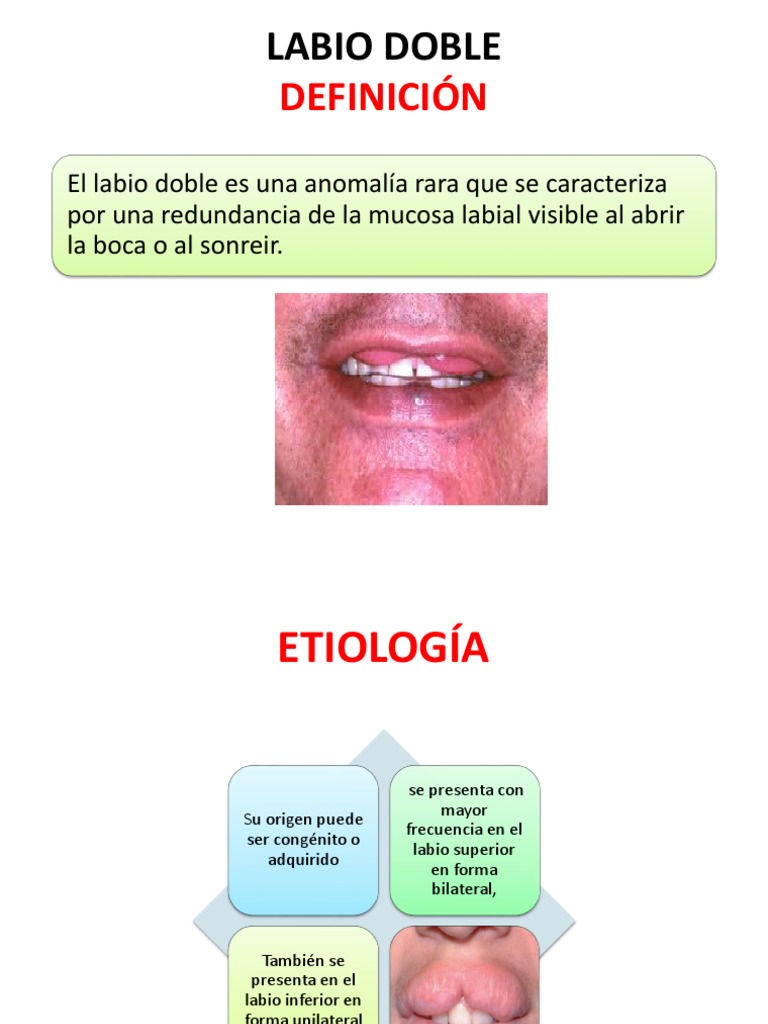 Tercera Parte Labio Doble | Membrana mucosa | Anatomía