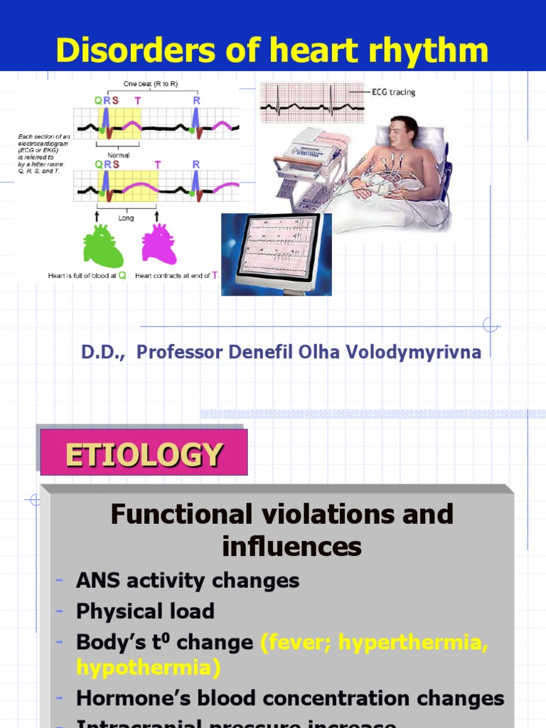 Heart Rhythm Disorders Overview | PDF | Electrocardiography | Atrium ...