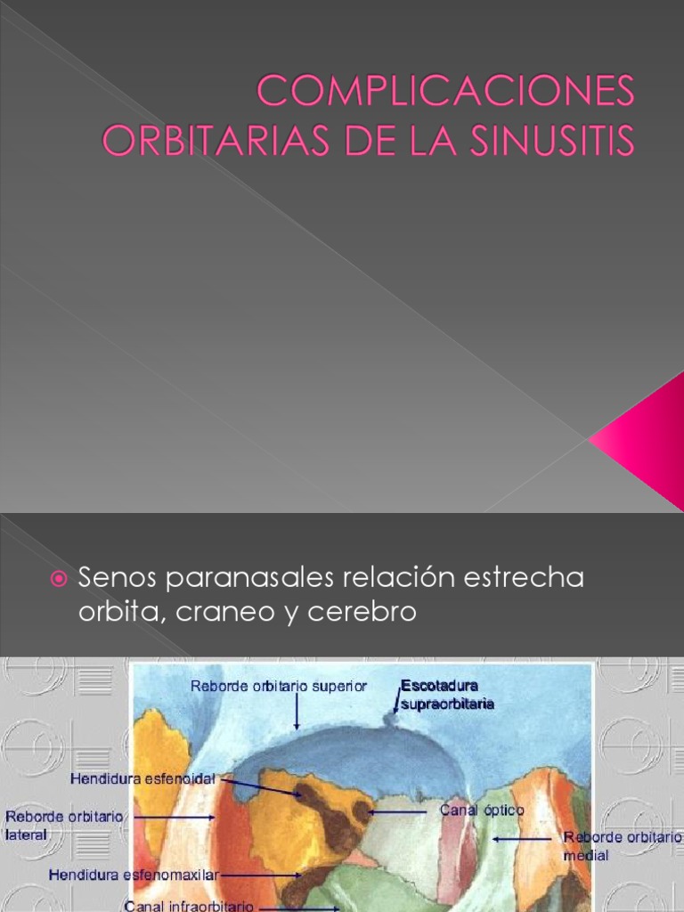 Complicaciones Orbitarias de La Sinusitis | PDF | Anatomía humana | Epidemiología