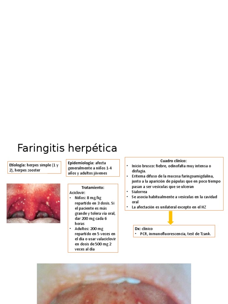 Faringitis | PDF | Especialidades Medicas | Medicina CLINICA