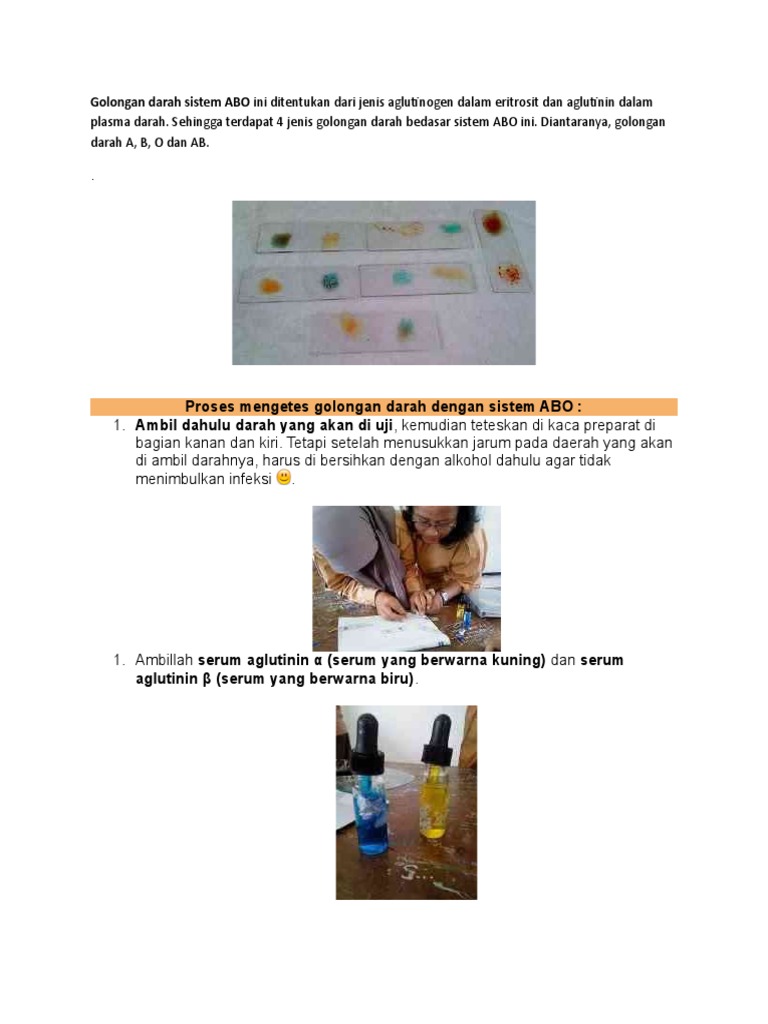 Golongan Darah Sistem ABO Ini Ditentukan Dari Jenis Aglutinogen Dalam ...