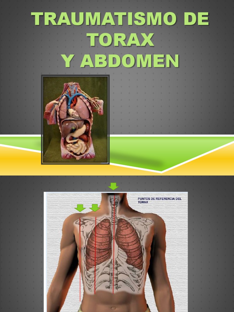 Trauma Torax y abdomen | Lesión | Tórax