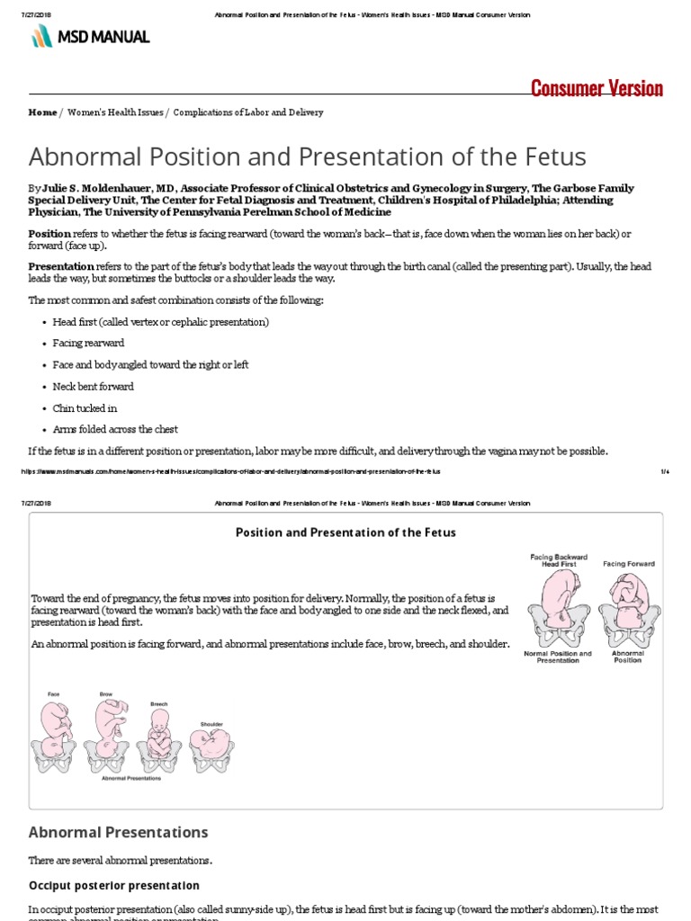 Abnormal Position and Presentation of The Fetus: Consumer Version ...