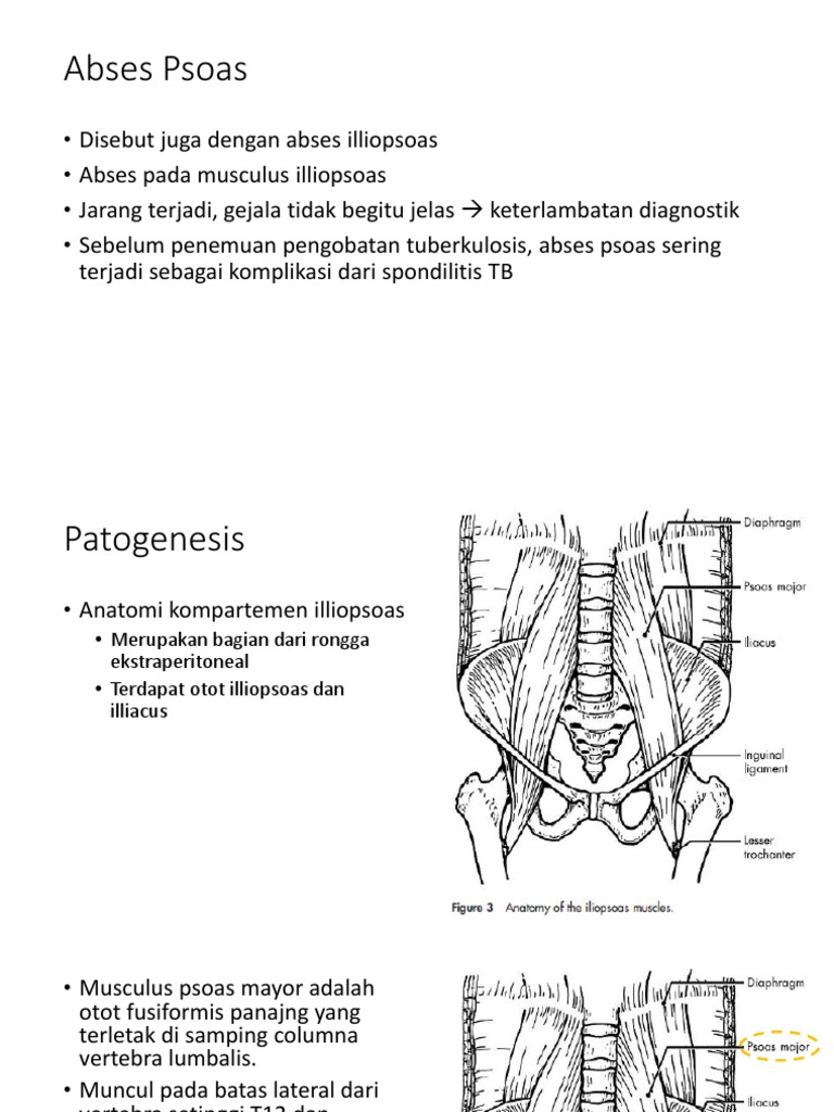 Abses Psoas Slide | PDF