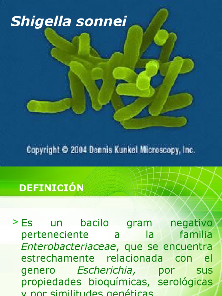 Shigella Sonnei Expo | PDF | Especialidades Medicas | Biología