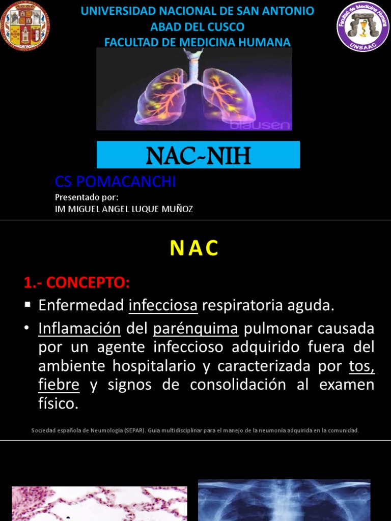 NAC Y NIH | Neumonía | Enfermedades y trastornos