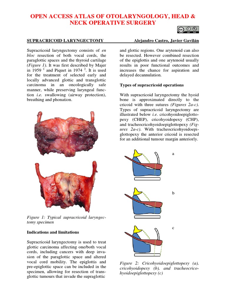 Open Access Atlas of Otolaryngology, Head & Neck Operative Surgery ...