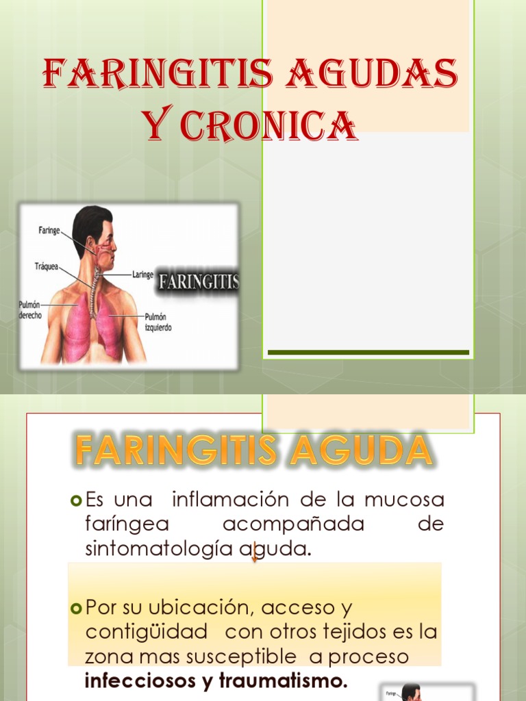 Faringitis Aguda y Crónica: Causas y Tratamiento | PDF | Candidiasis ...