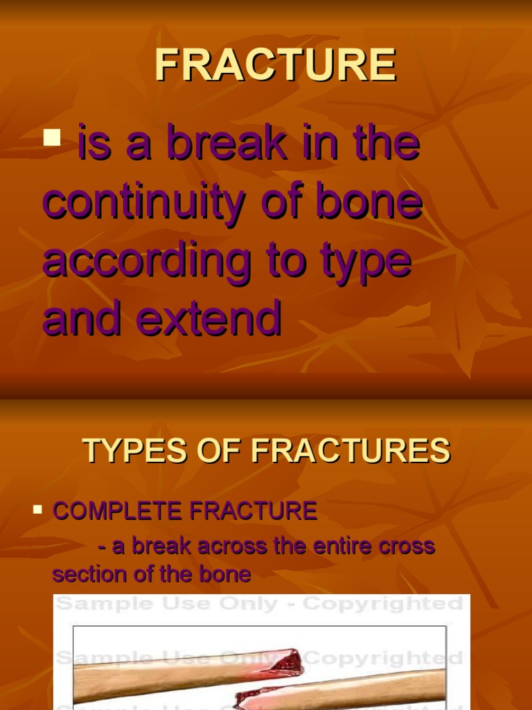 Types of Bone Fractures | PDF | Language Arts & Discipline