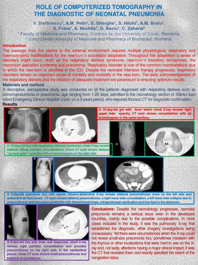 Role of CT in diagnosing neonatal pneumonia | PDF | Pneumonia | Ct Scan