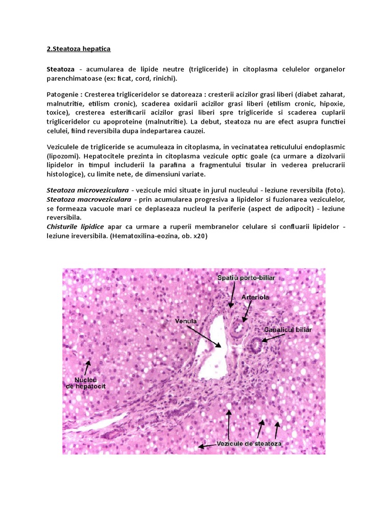 2 Steatoza-Hepatica | PDF