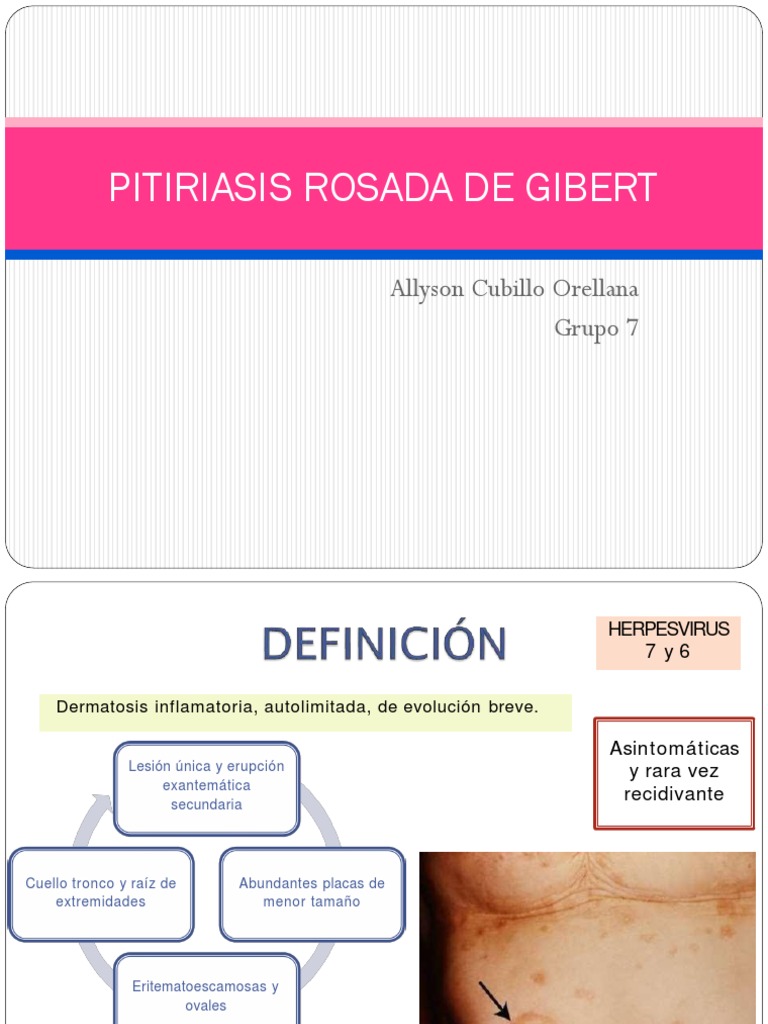 Pitiriasis Rosada de Gibert | PDF | Especialidades Medicas | Medicina ...