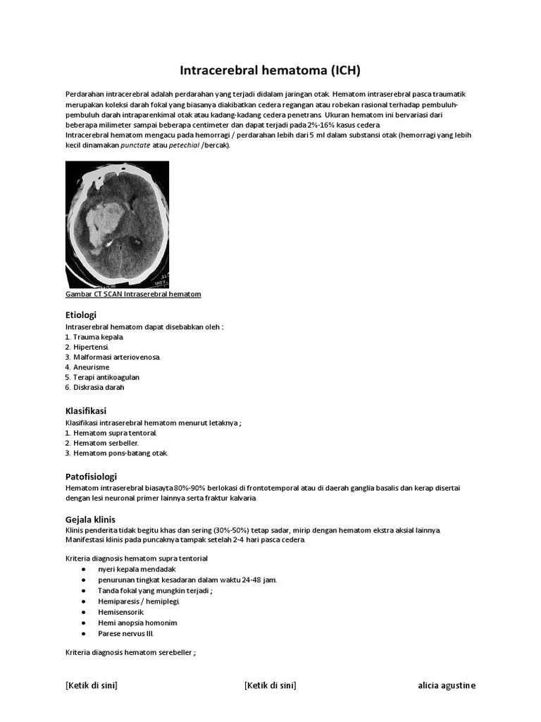 Intracranial Hematoma Definition – Netzdot