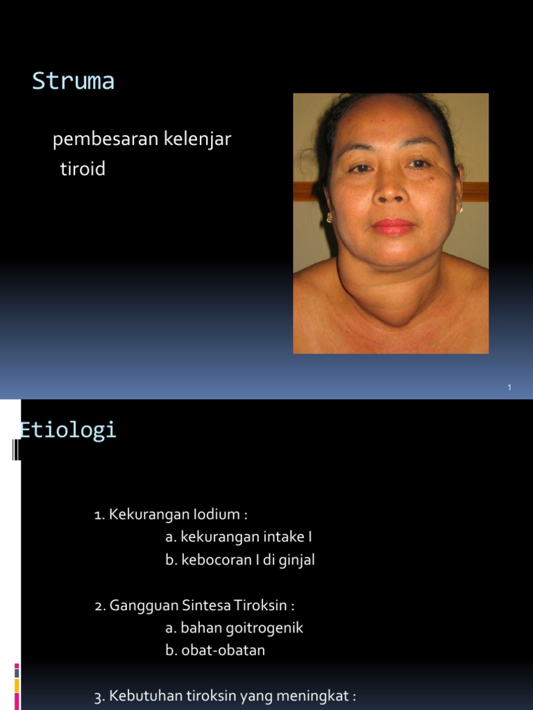 KL - Struma | PDF | Sains & Matematika