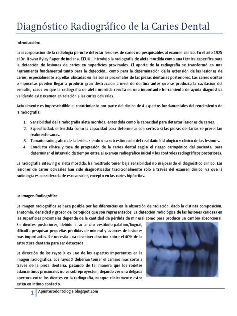 Diagnóstico Radiográfico de La Caries Dental | Diagnostico medico | Rayo X