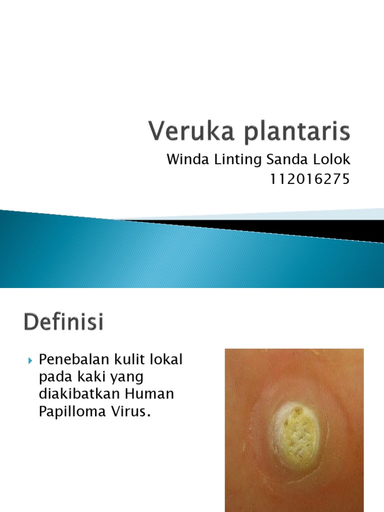 Veruka Plantaris | PDF