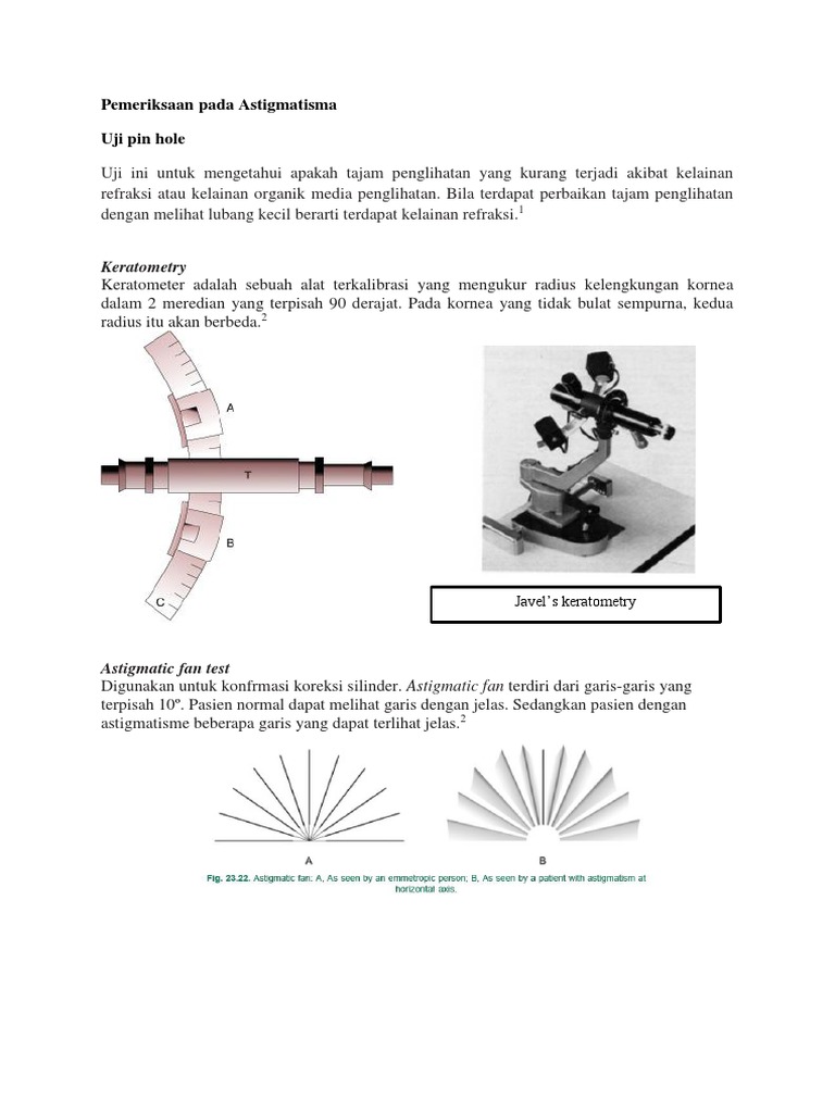 Pemeriksaan Pada Astigmatisma | PDF