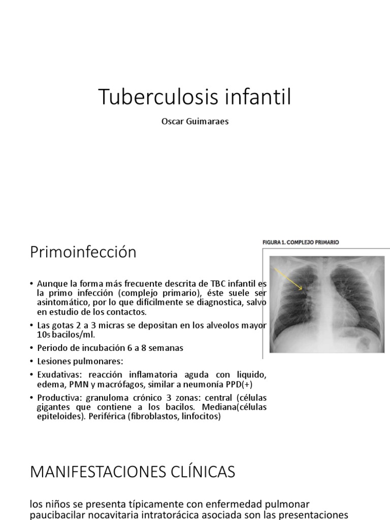 Tuberculosis Infantil | PDF | Tuberculosis | Epidemiología