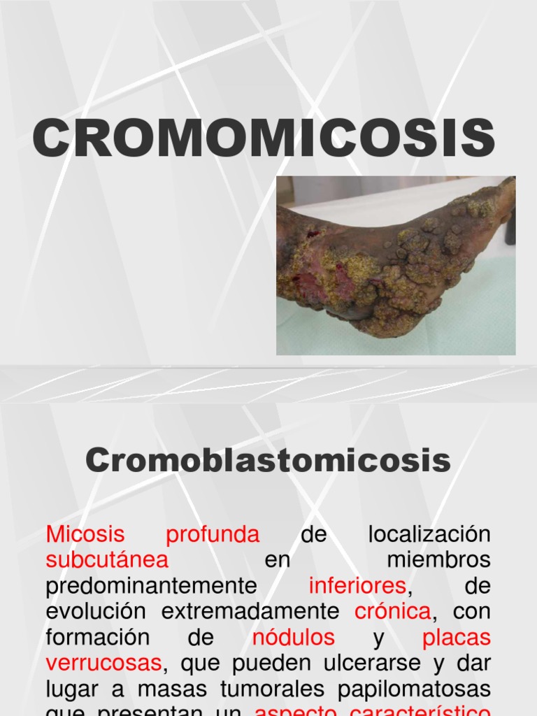 Cromomicosis | PDF | Especialidades Medicas | Enfermedades y trastornos