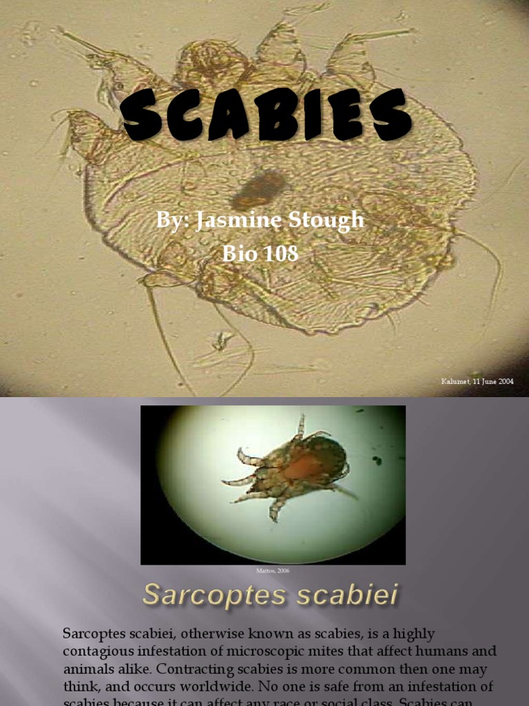 Scabies: By: Jasmine Stough Bio 108 | PDF | Diseases And Disorders ...