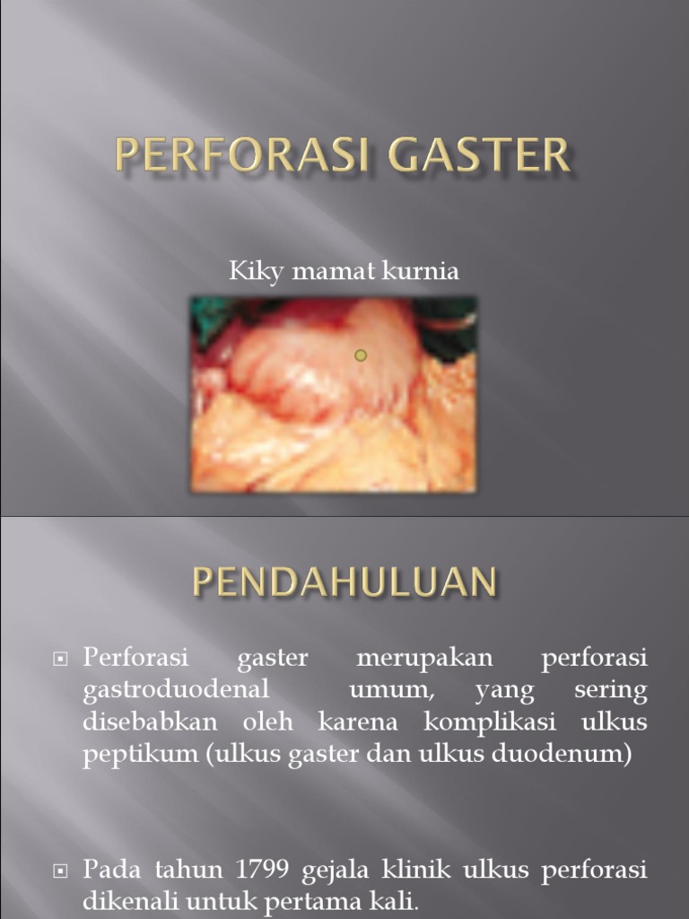 Perforasi Gaster | PDF