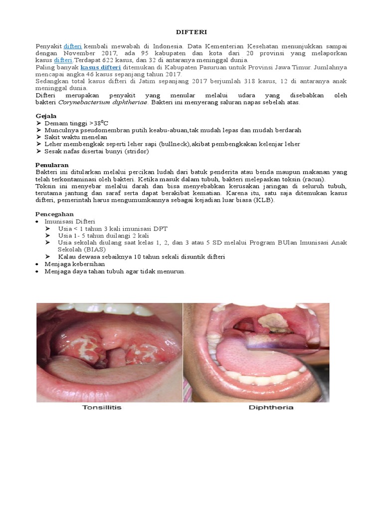 Difteri | PDF