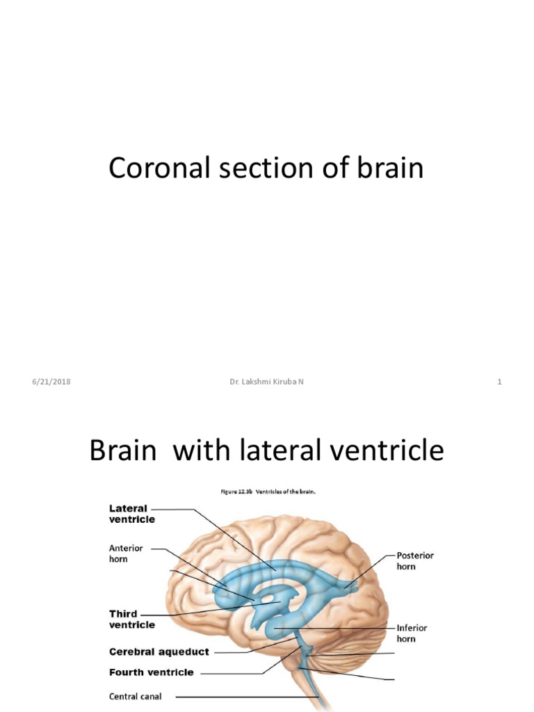 Coronal Section of Brain Labelled-1