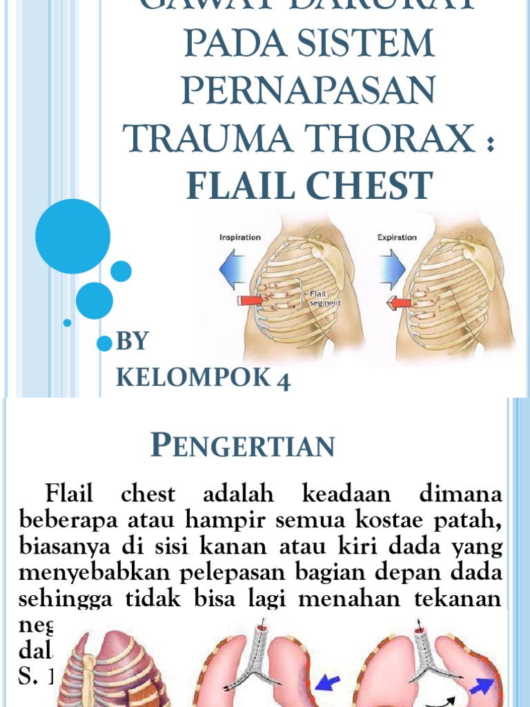 Flail Chest: Penanganan dan Komplikasi | PDF