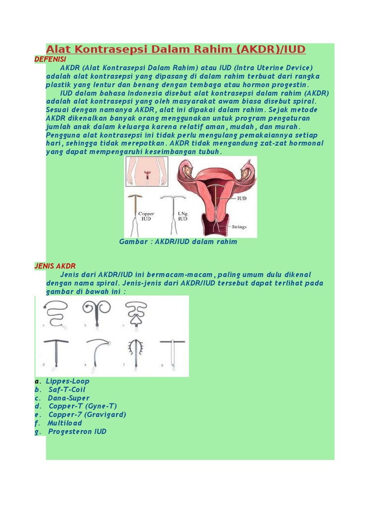 Iud | PDF