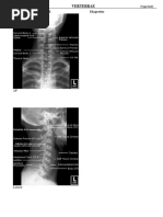 Radiologi Thorax Normal | PDF