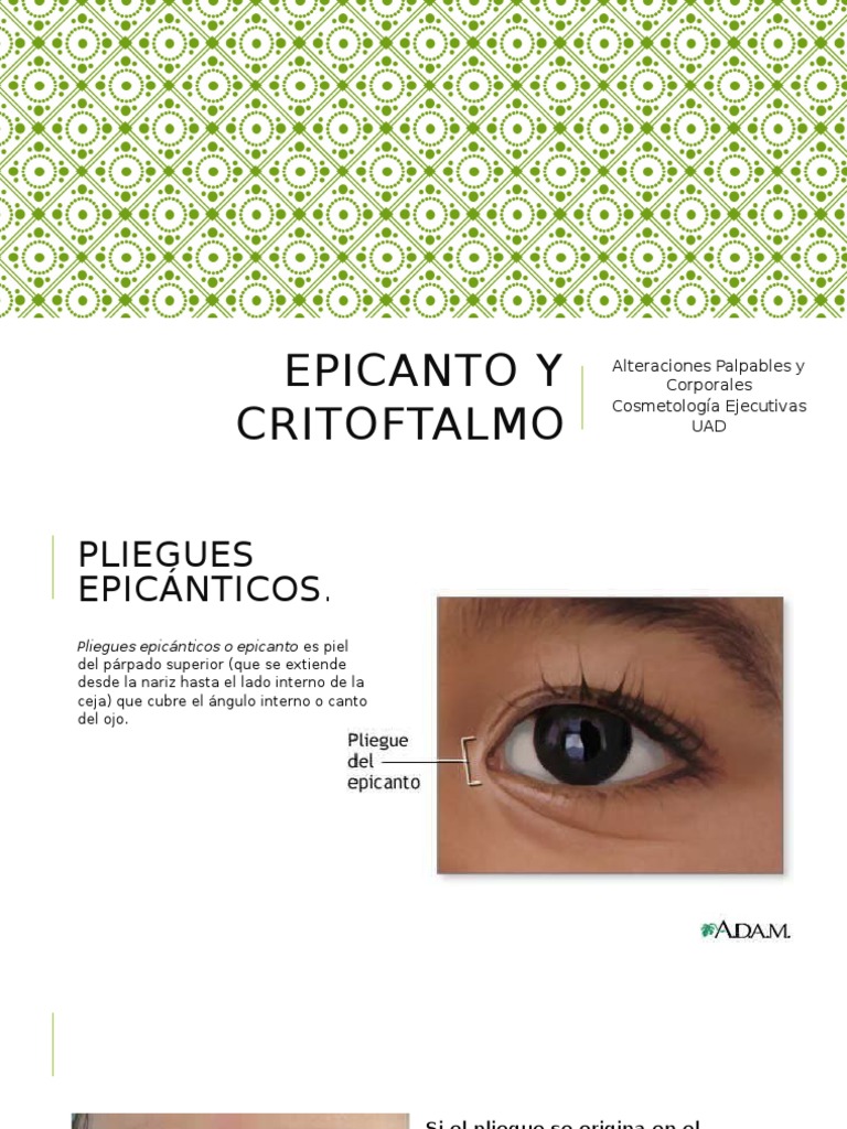 Epicanto y Critoftalmo | Medicina | Medicina CLINICA