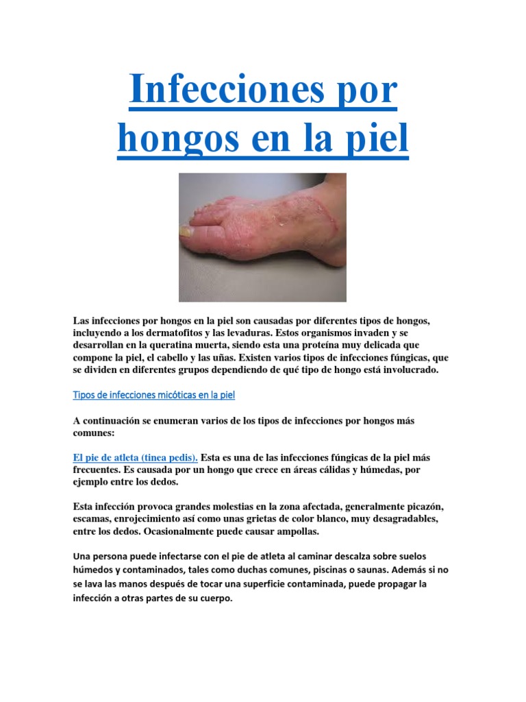 Infecciones Por Hongos en La Piel PDF GRATIS. | Candidiasis | Clavo ...