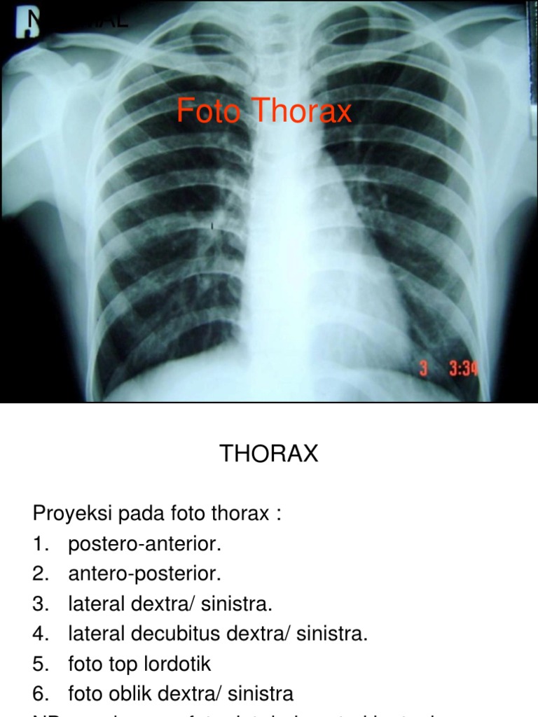 Foto Thorax | PDF