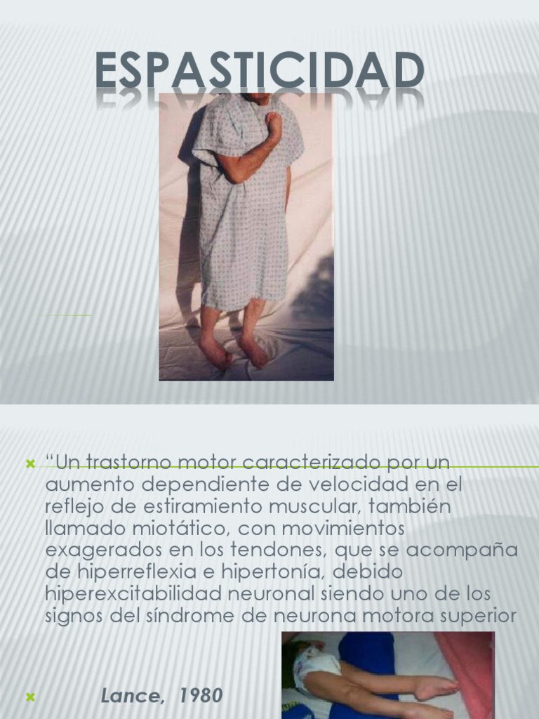 Espasticidad | PDF | Cerebro | Neurona
