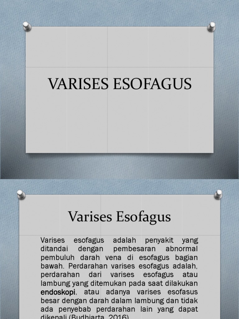 vARISES eSOFAGUS | PDF