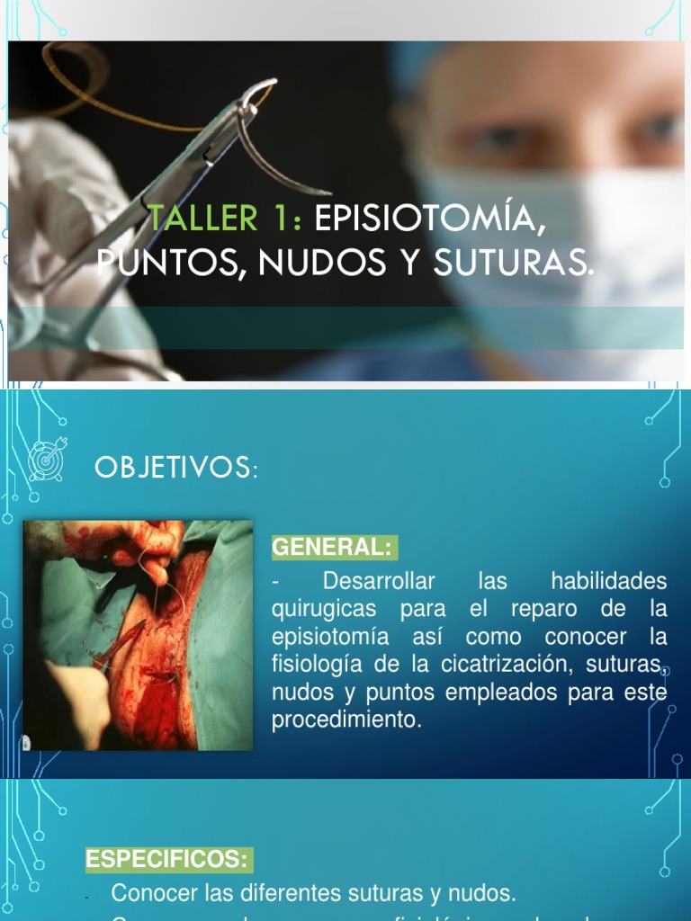 Episiotomía Completo | PDF | Cicatrización de la herida ...