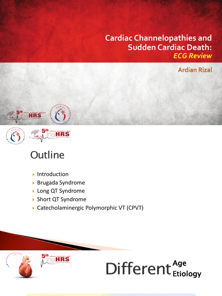 ECG in Cardiac Channelopathies | PDF | Cardiology | Cardiovascular Diseases