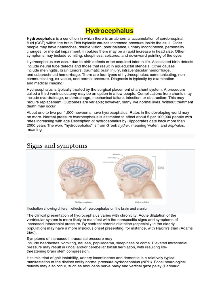 Hydrocephalus: An Abnormal Buildup of Cerebrospinal Fluid in the Brain ...
