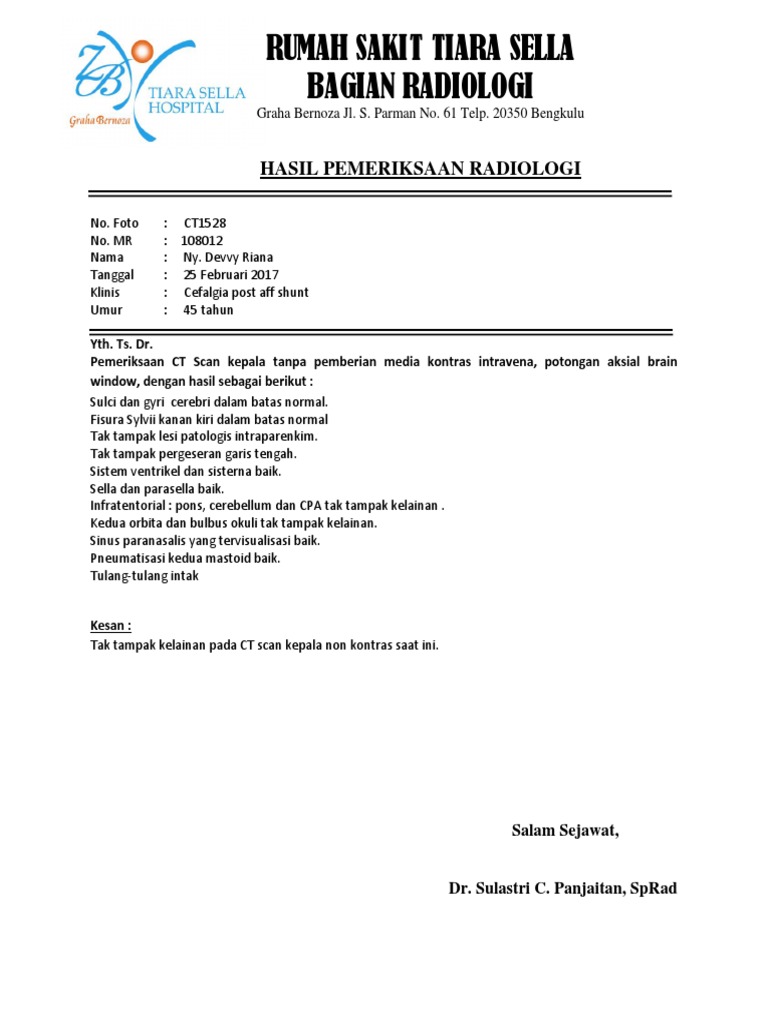CT Scan Kepala Normal1 | PDF