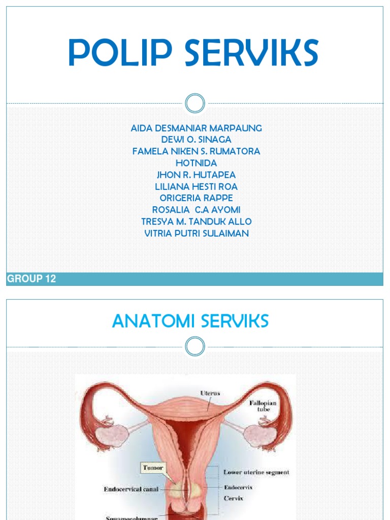 Polip Serviks 12 | PDF