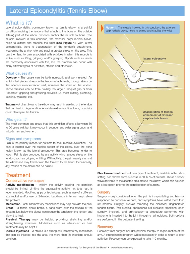 Lateral Epicondylitis (Tennis Elbow) : What Is It? | PDF | Clinical ...