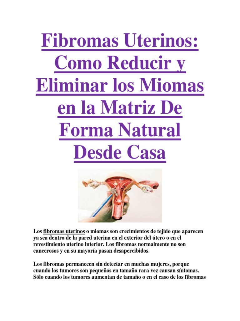 Fibromas Uterinos: Como Reducir y Eliminar Los Miomas en La Matriz de ...